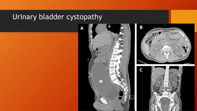 Applied anatomy, GU system.pptx | Reproductive Health | Diseases and ...