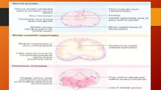 Applied anatomy, GU system.pptx