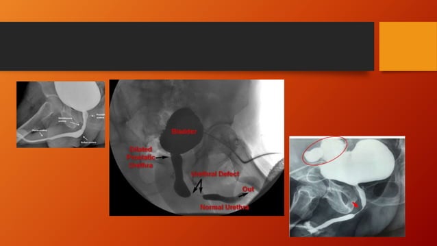 Applied anatomy, GU system.pptx | Reproductive Health | Diseases and ...