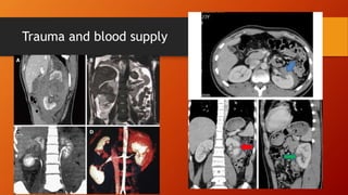 Applied anatomy, GU system.pptx