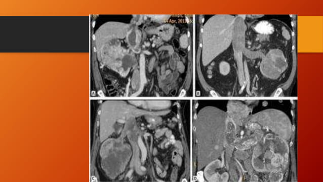 Applied anatomy, GU system.pptx | Reproductive Health | Diseases and ...