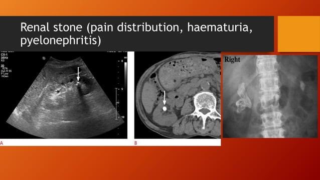 Applied anatomy, GU system.pptx | Reproductive Health | Diseases and ...