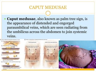 Applied anatomy of portal circulation | PPTX