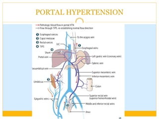 Applied anatomy of portal circulation | PPTX