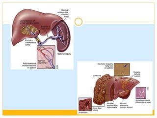 Applied anatomy of portal circulation | PPTX