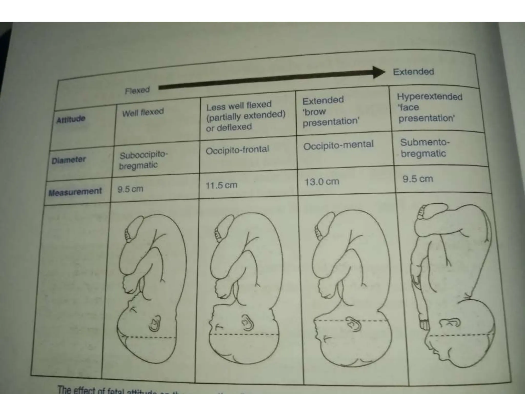 applied anatomy of fetal skull 12345.pptx