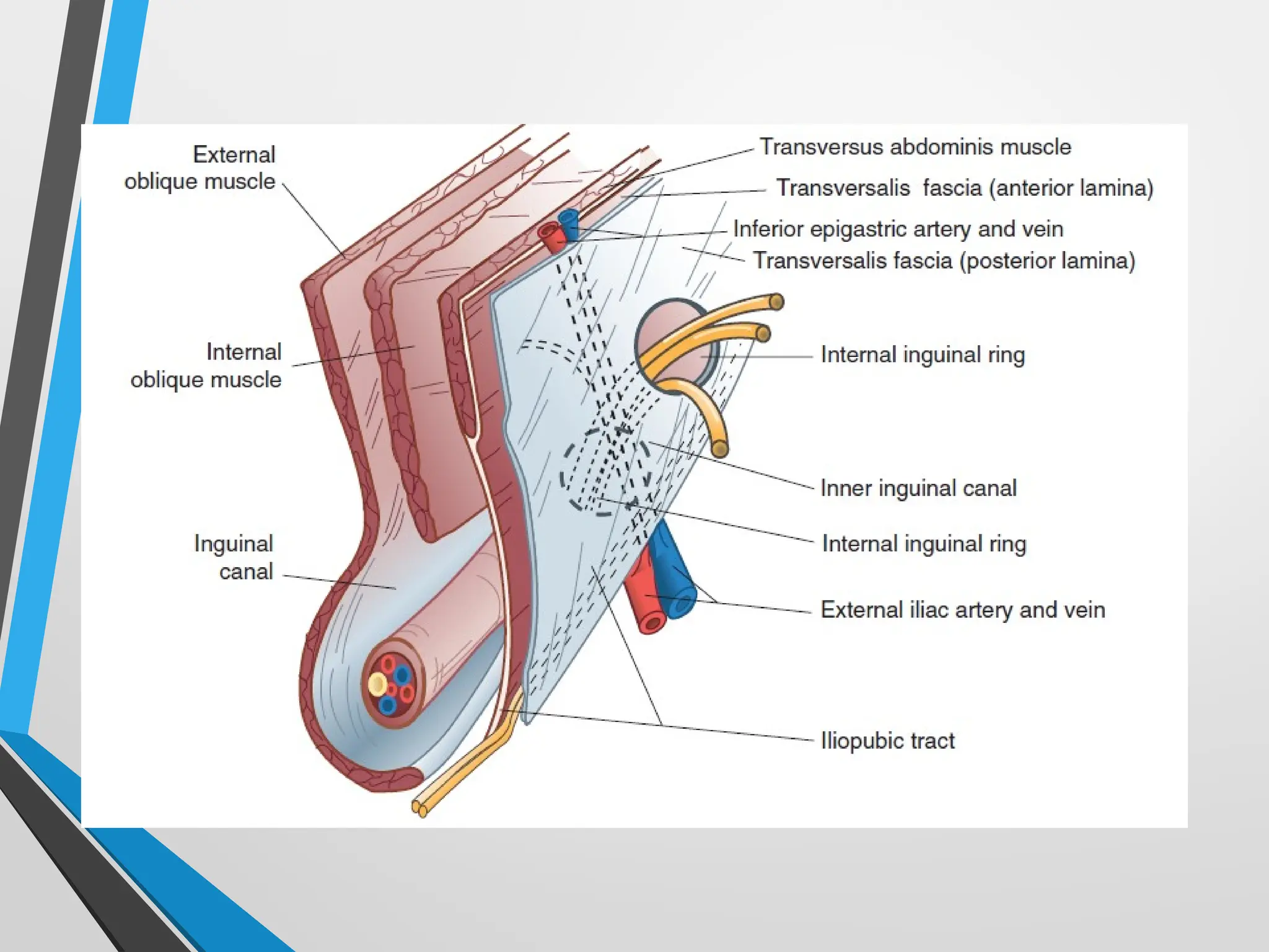 Applied anatomy of inguinal hernias.pptx