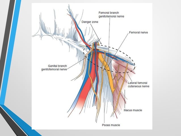 Applied anatomy of inguinal hernias.pptx