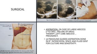 APPLIED ANATOMY OF LIVER AND LIVER ABSCESS (2).pptx