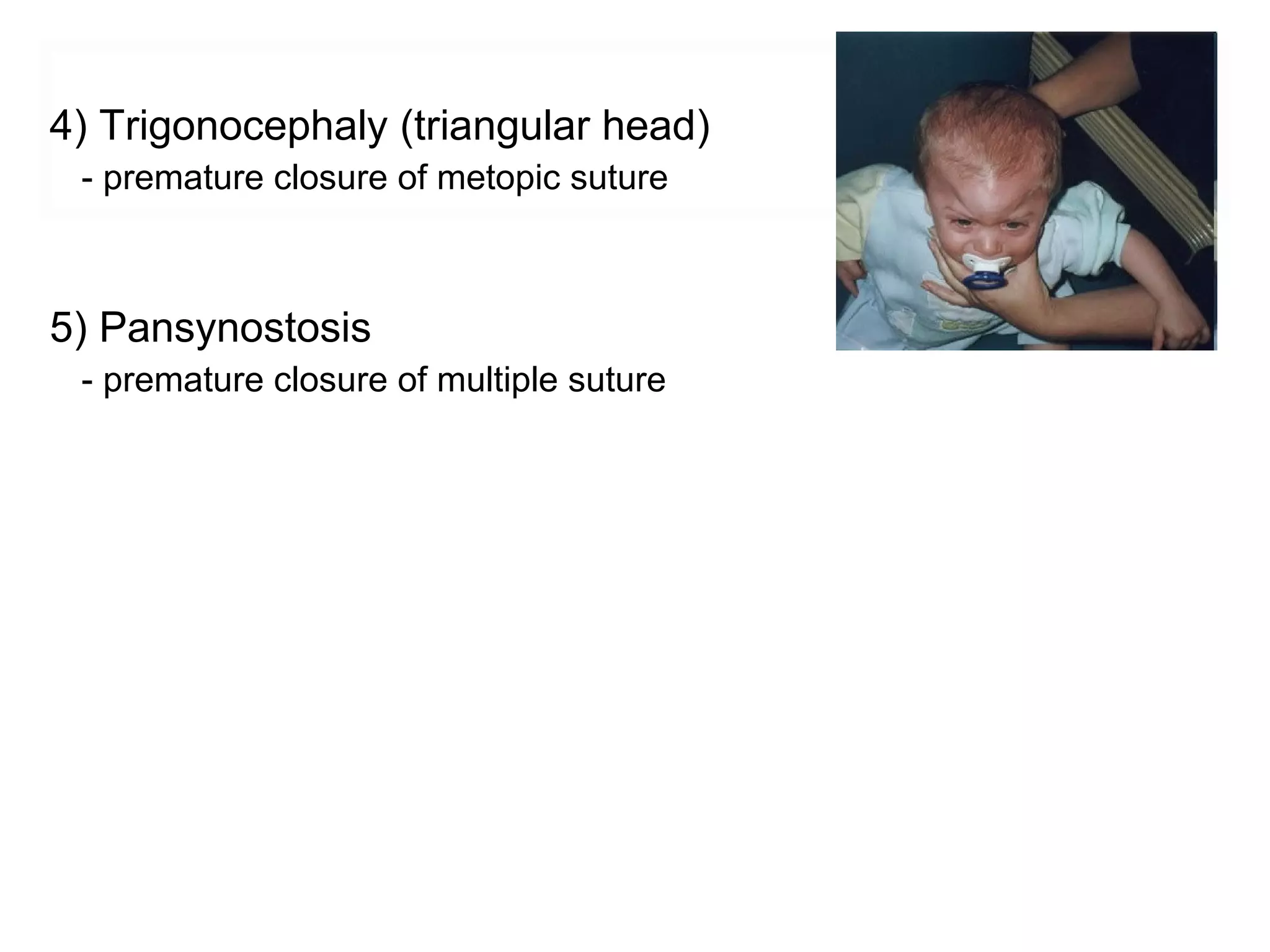 Applied anatomy of pelvis and fetal skull | PPT