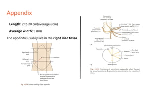 Applied Anatomy of Right Iliac Fossa, Small Bowel and Large Bowel..pptx