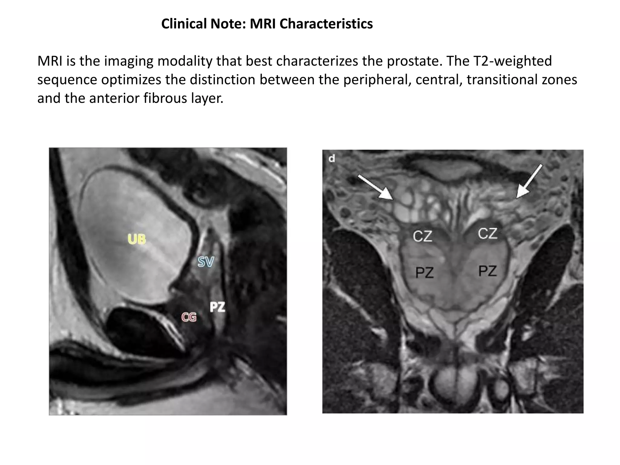 Applied anatomy of the prostate and seminal vesicles | PPTX
