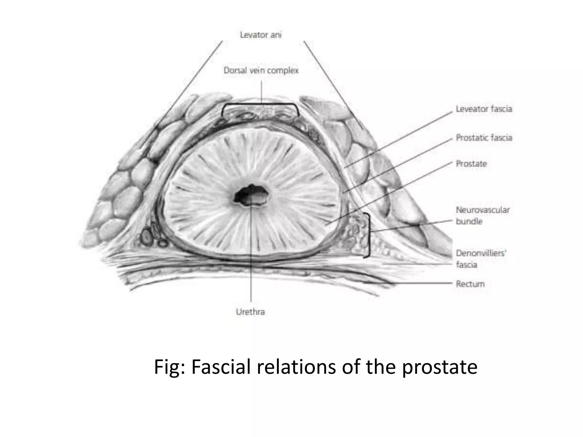 Applied anatomy of the prostate and seminal vesicles | PPTX