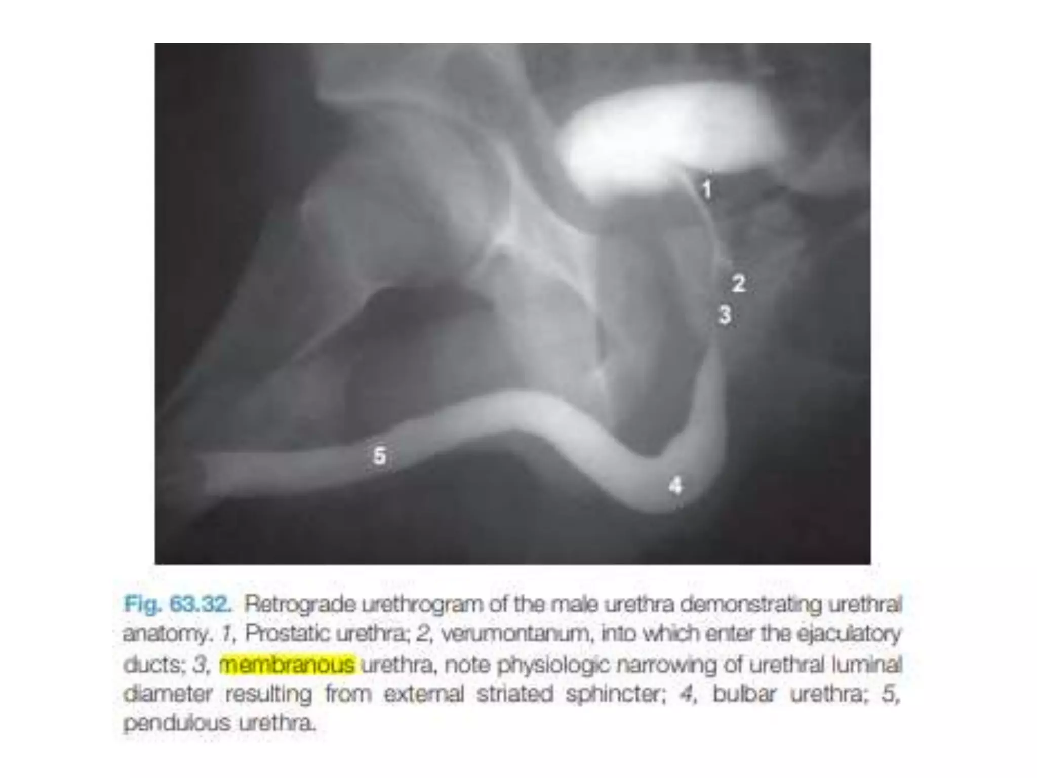 Applied anatomy of the prostate and seminal vesicles | PPTX