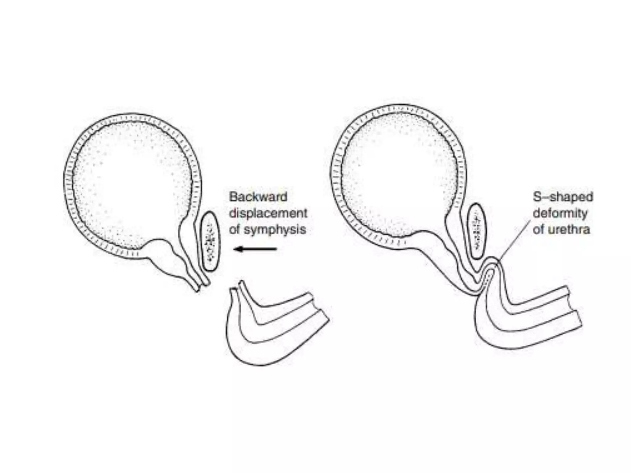 Applied anatomy of the prostate and seminal vesicles | PPTX