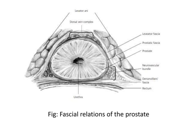 Applied anatomy of the prostate and seminal vesicles | PPTX