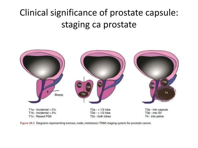 Applied anatomy of the prostate and seminal vesicles | PPTX