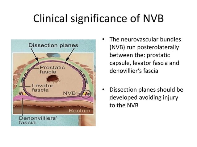 Applied anatomy of the prostate and seminal vesicles | PPTX