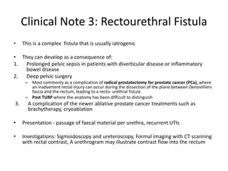Applied anatomy of the prostate and seminal vesicles | PPTX