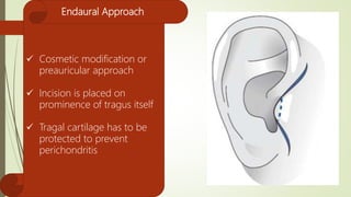 Applied anatomy of tmj | PPTX
