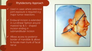 Applied anatomy of tmj | PPTX