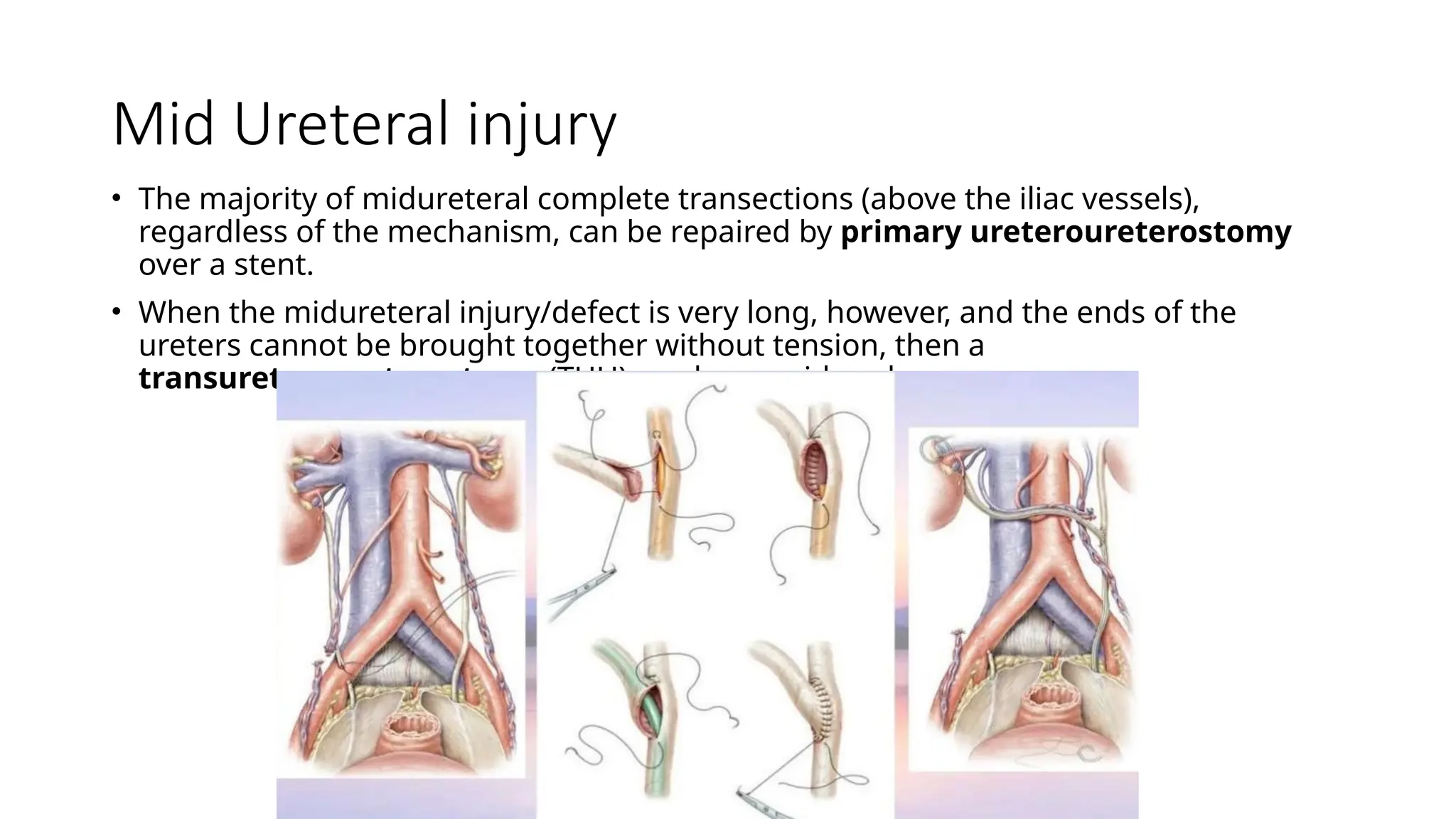 Applied Anatomy of Ureter in detail for urologist | PPTX
