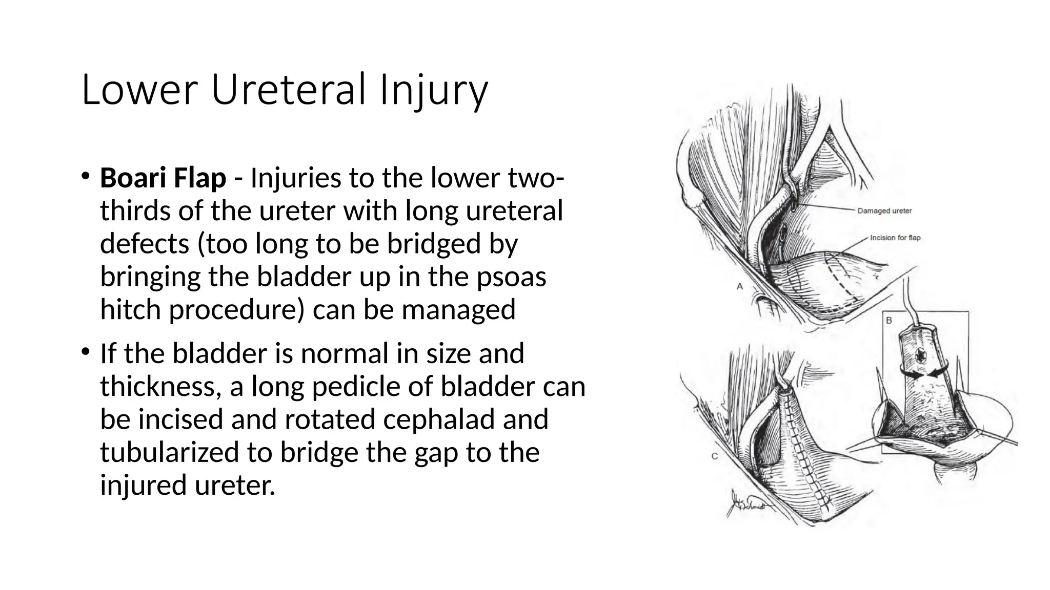 Applied Anatomy of Ureter in detail for urologist | PPTX