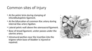 Applied Anatomy of Ureter in detail for urologist | PPTX