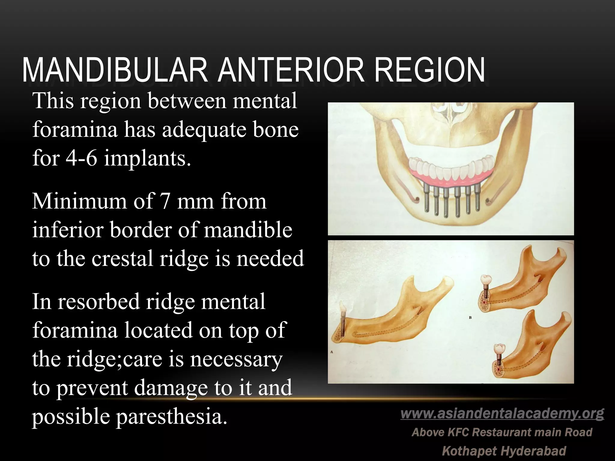 Applied anatomy,physiology for dental implants | PDF