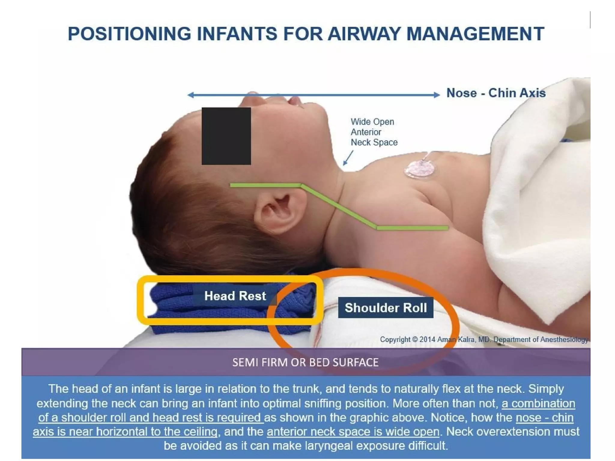 Applied anatomy & physiology for paediatric anaesthesia | PPT