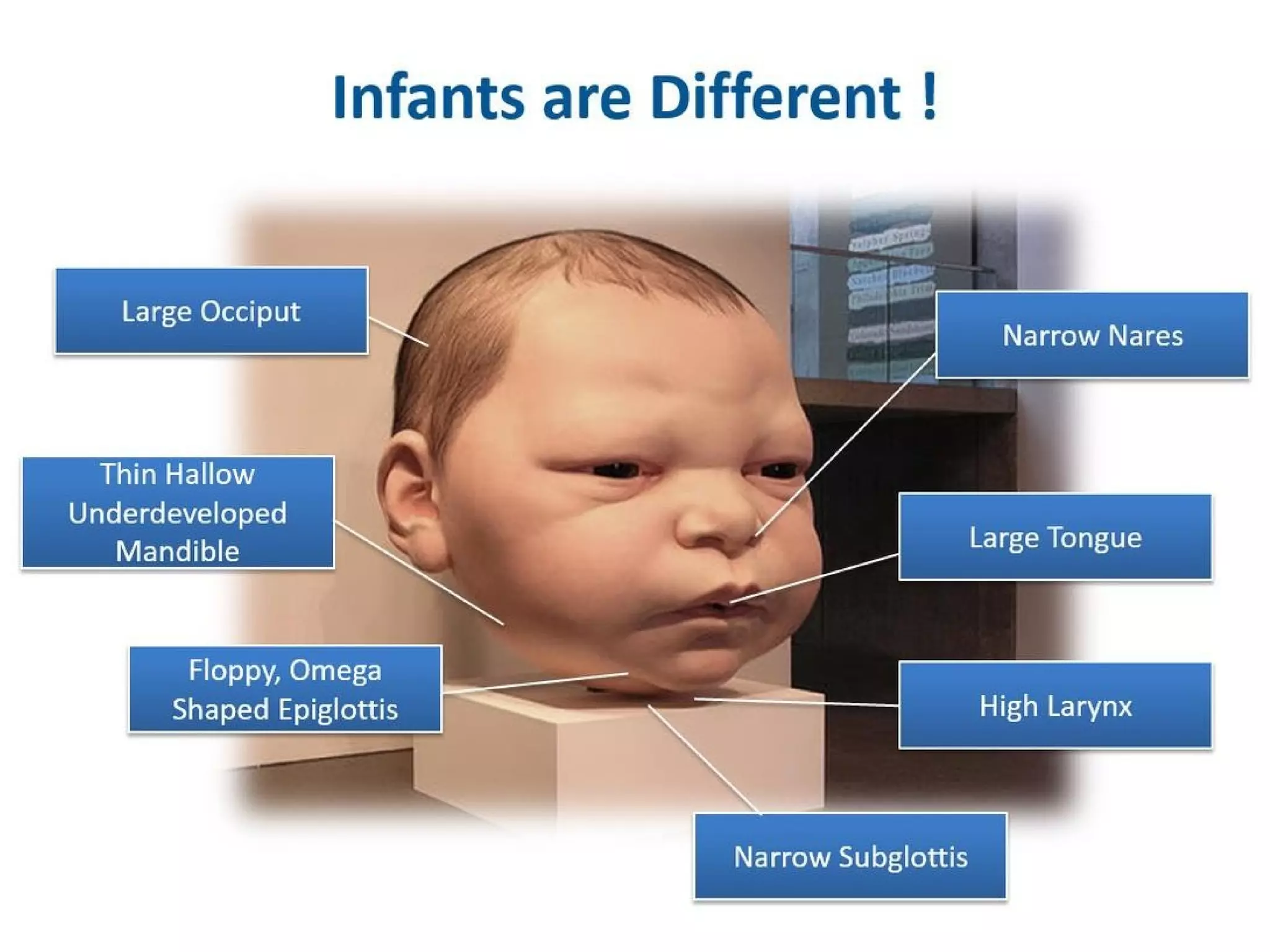 Applied anatomy & physiology for paediatric anaesthesia | PPT