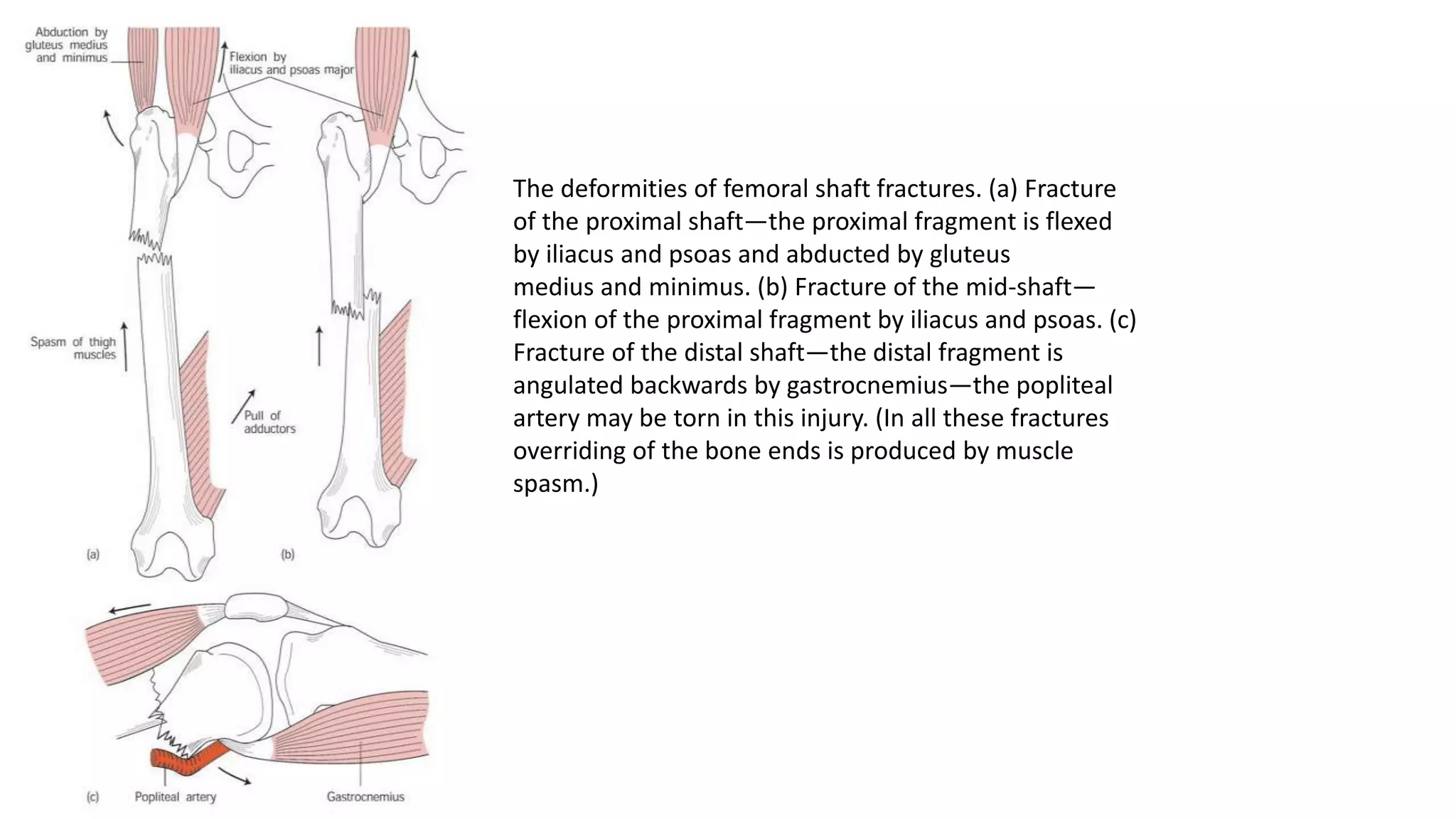 Applied and clinical anatomy of lower limb | PPTX