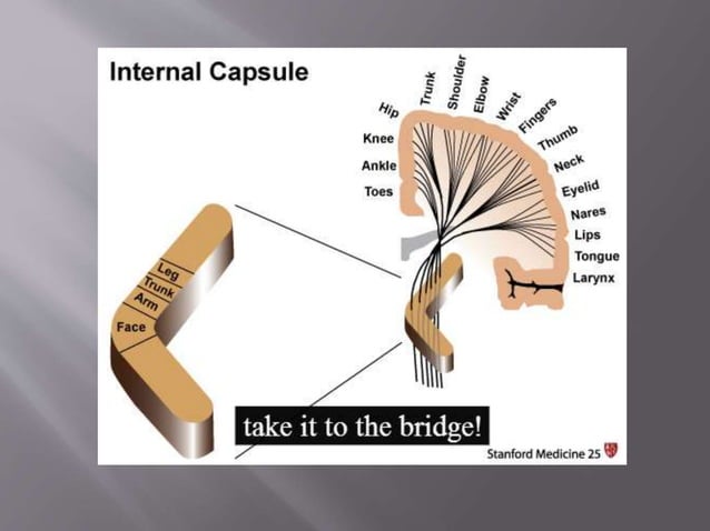 Applied aspect of internal capsule | PPTX | Brain and Nervous System ...