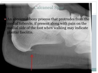 Applied aspect regarding the sole of foot | PPTX