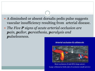 Applied aspect regarding the sole of foot | PPTX