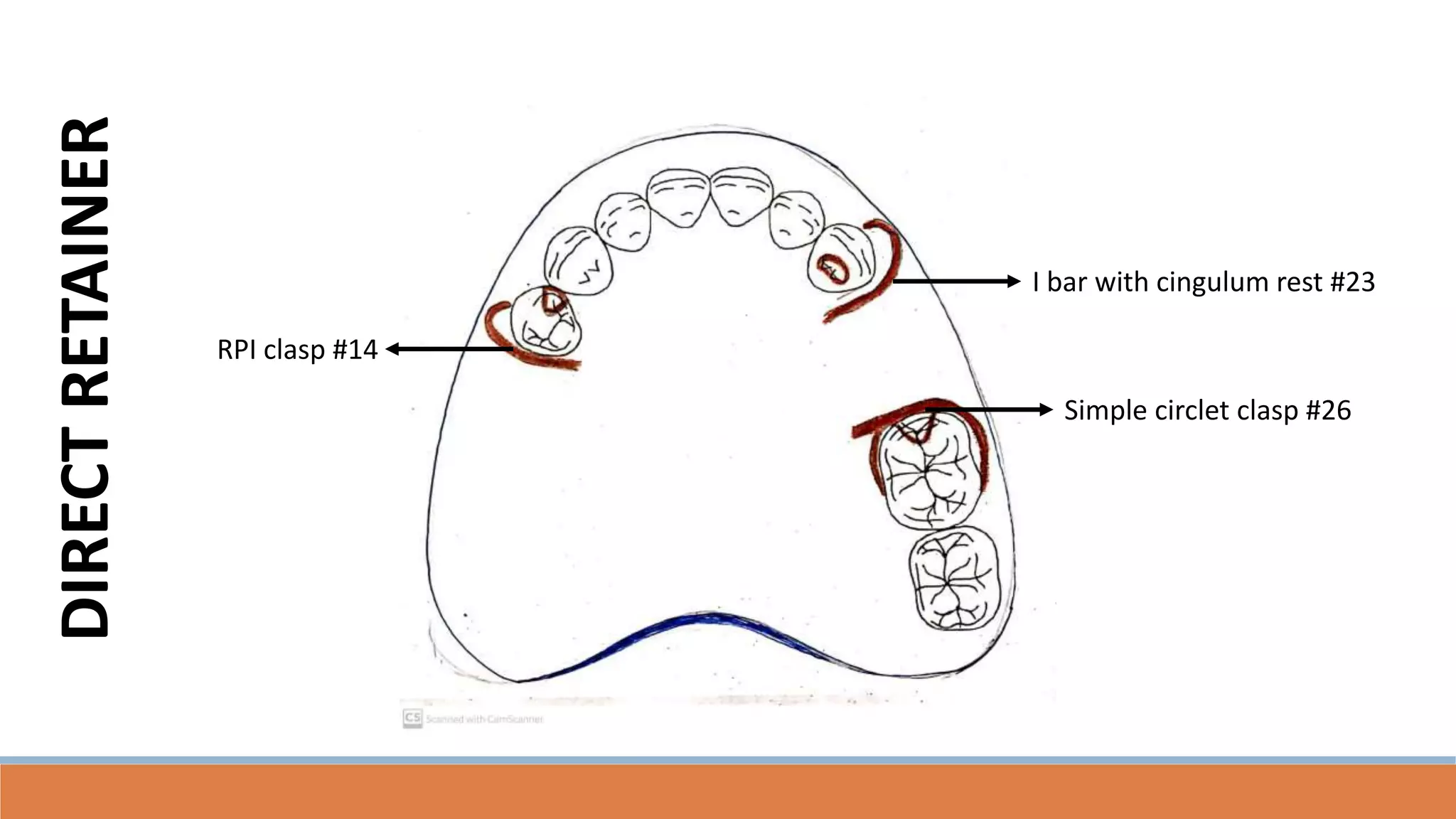 APPLIED ASPECTS OF CAST PARTIAL DENTURE DESIGNING.pptx