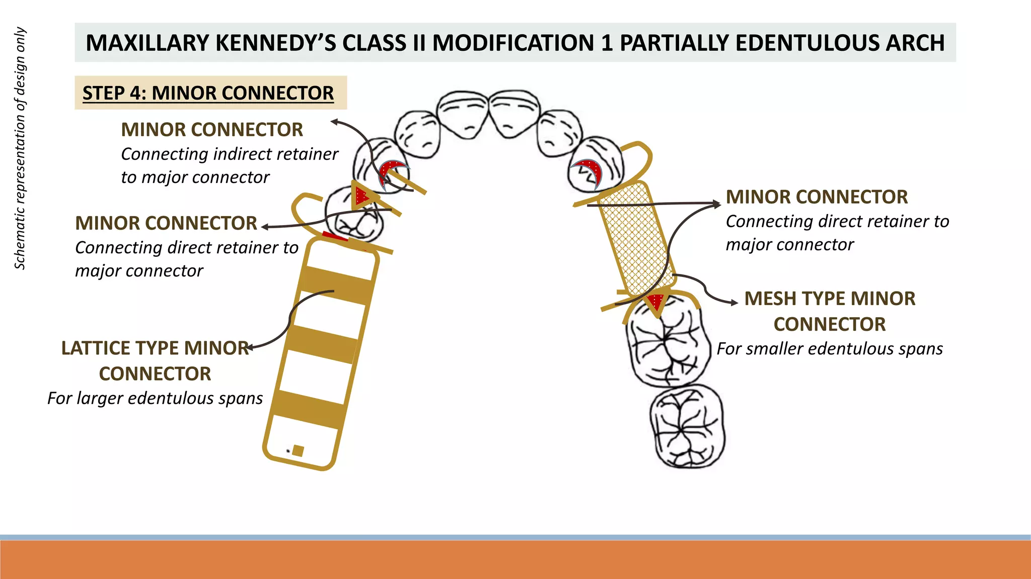 APPLIED ASPECTS OF CAST PARTIAL DENTURE DESIGNING.pptx