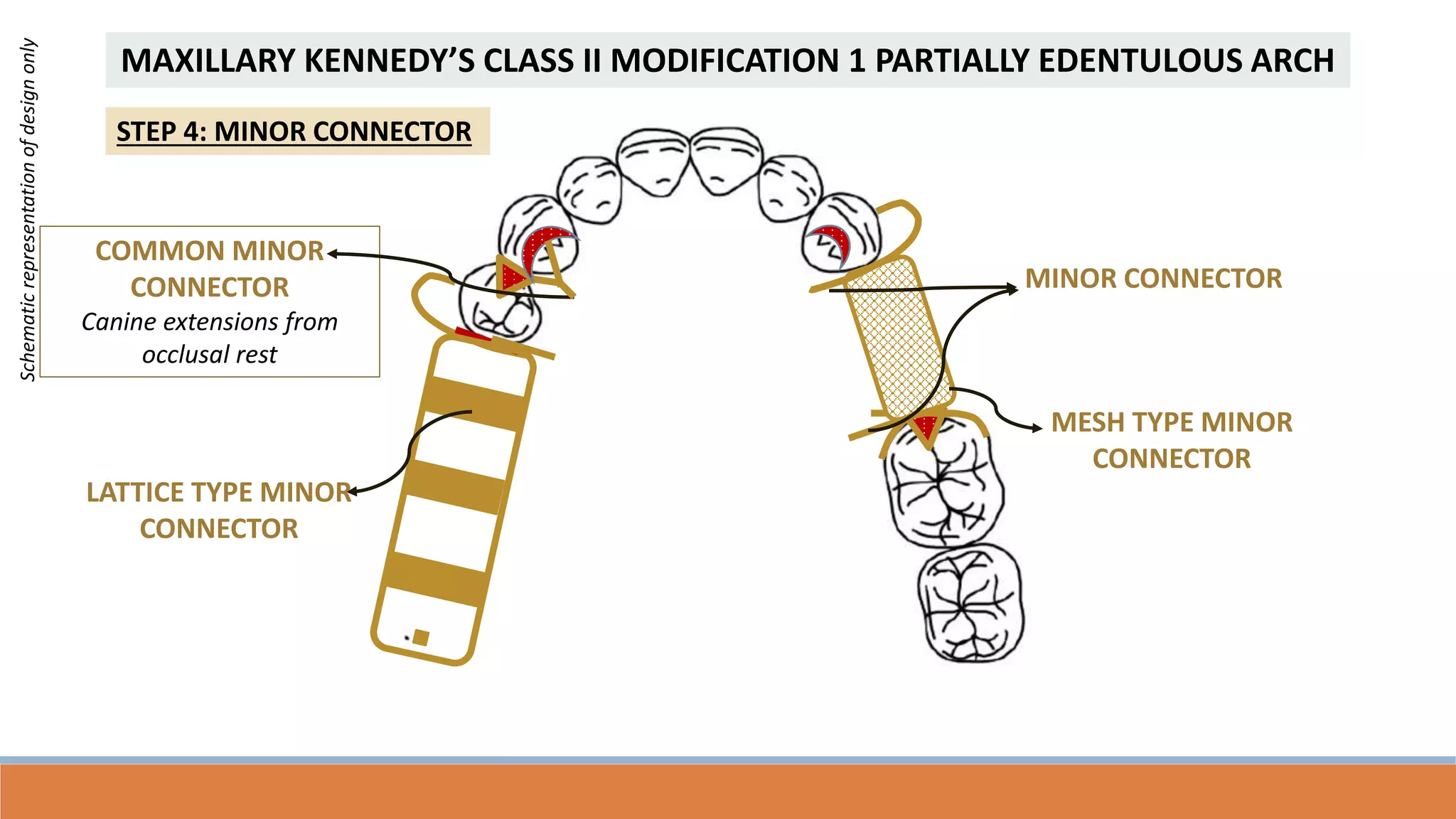 APPLIED ASPECTS OF CAST PARTIAL DENTURE DESIGNING.pptx