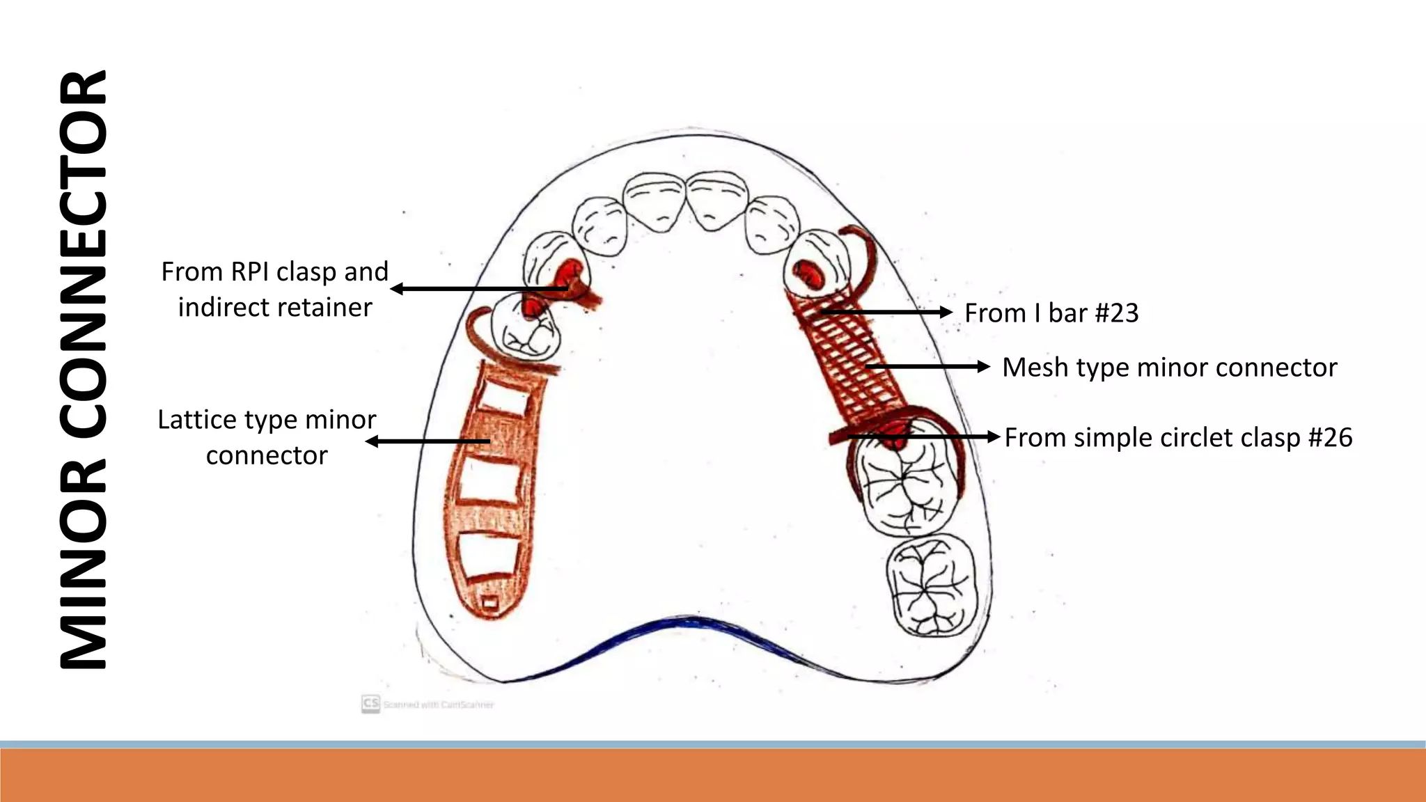 APPLIED ASPECTS OF CAST PARTIAL DENTURE DESIGNING.pptx