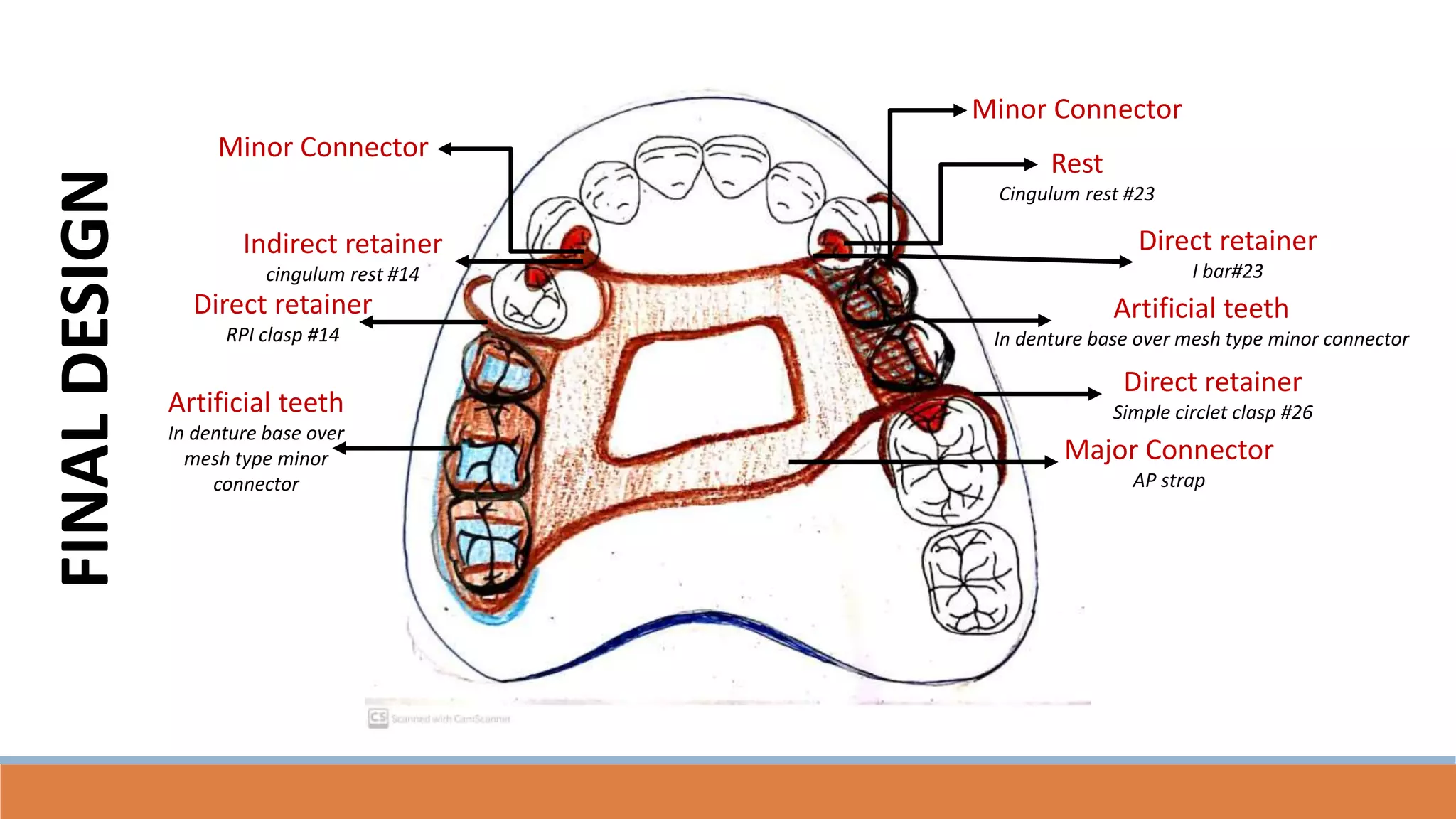 APPLIED ASPECTS OF CAST PARTIAL DENTURE DESIGNING.pptx