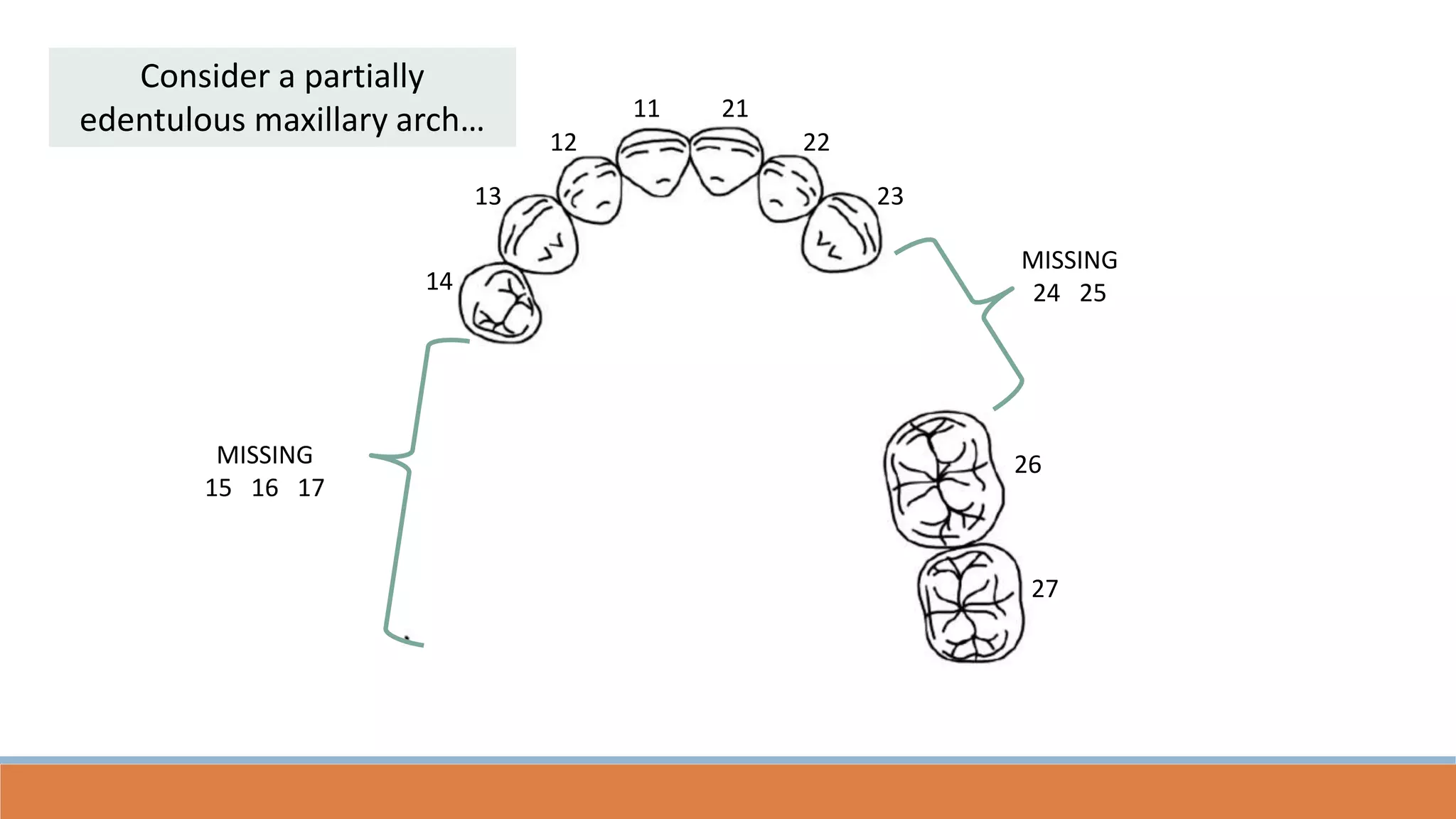 APPLIED ASPECTS OF CAST PARTIAL DENTURE DESIGNING.pptx