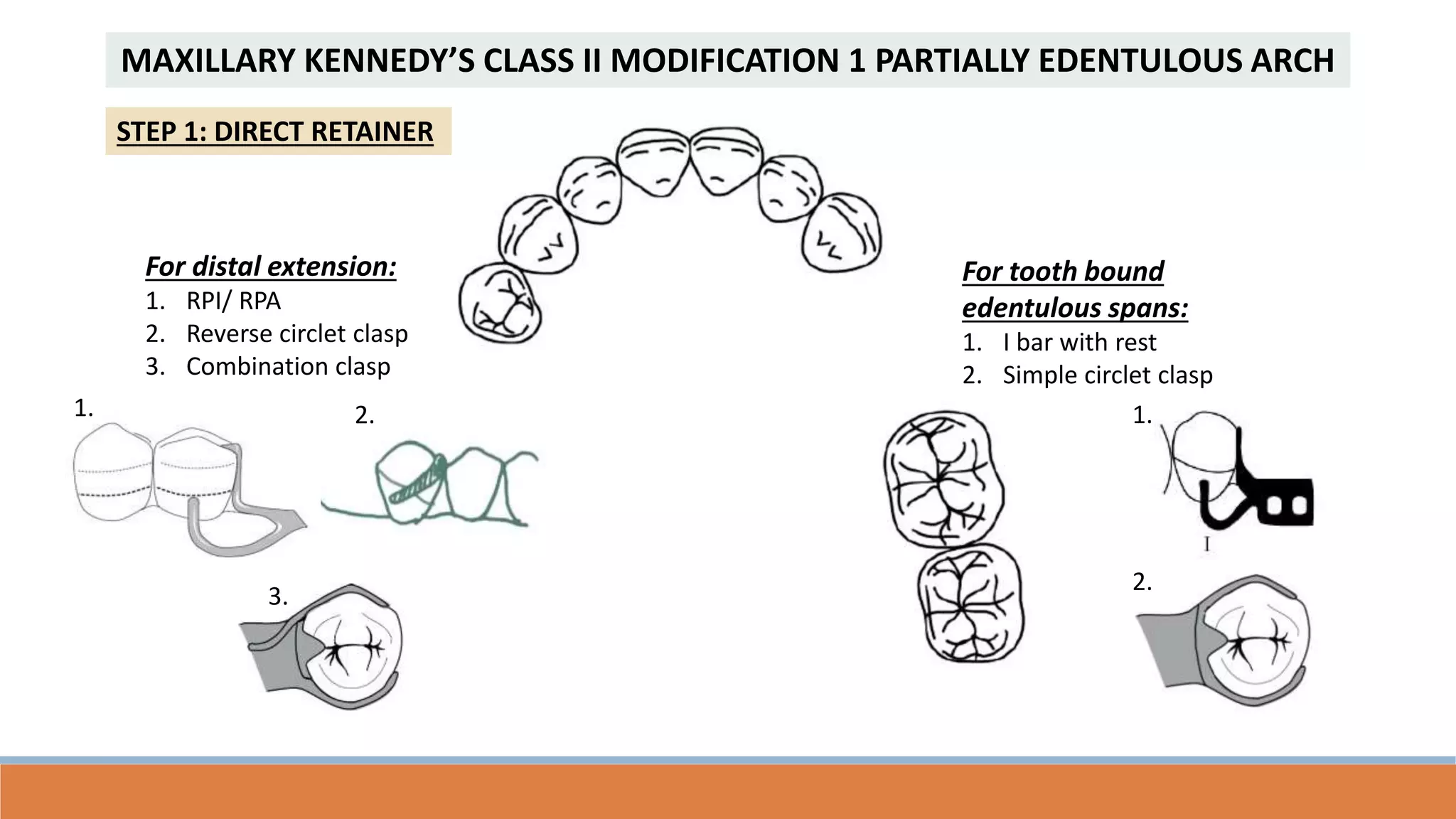 APPLIED ASPECTS OF CAST PARTIAL DENTURE DESIGNING.pptx
