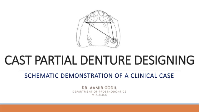 APPLIED ASPECTS OF CAST PARTIAL DENTURE DESIGNING.pptx | Oral care ...