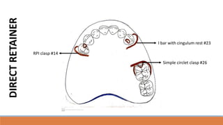 APPLIED ASPECTS OF CAST PARTIAL DENTURE DESIGNING.pptx