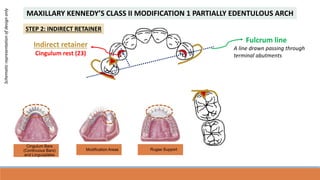 APPLIED ASPECTS OF CAST PARTIAL DENTURE DESIGNING.pptx