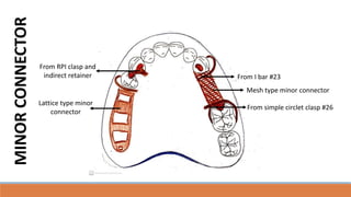 APPLIED ASPECTS OF CAST PARTIAL DENTURE DESIGNING.pptx