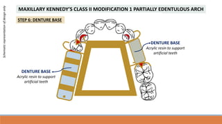 APPLIED ASPECTS OF CAST PARTIAL DENTURE DESIGNING.pptx