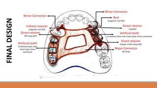 APPLIED ASPECTS OF CAST PARTIAL DENTURE DESIGNING.pptx