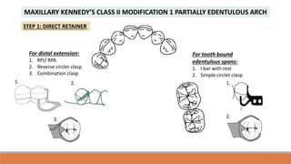 APPLIED ASPECTS OF CAST PARTIAL DENTURE DESIGNING.pptx