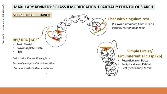 APPLIED ASPECTS OF CAST PARTIAL DENTURE DESIGNING.pptx | Oral care ...